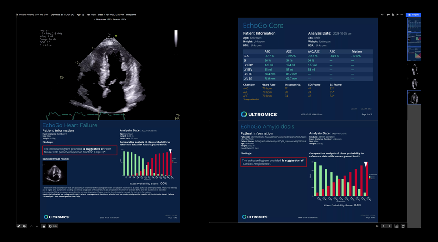 Next-generation Echocardiography is here - Ultromics Next-generation Echocardiography is here - Ultromics